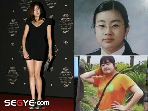 강소라, 과거 72kg 소녀에서 20kg 폭풍감량 | 세계일보