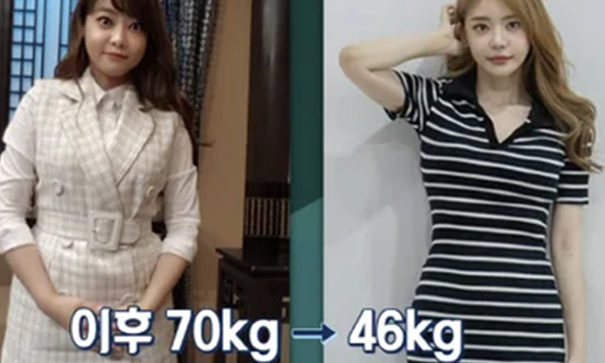 서유리, 갑상선 질환으로 70kg → 46kg 감량… “비만으로 지방간까지 같이 와” | 세계일보